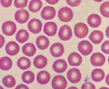 A guide to interpreting blood panels Part 1 Haematology - British ...