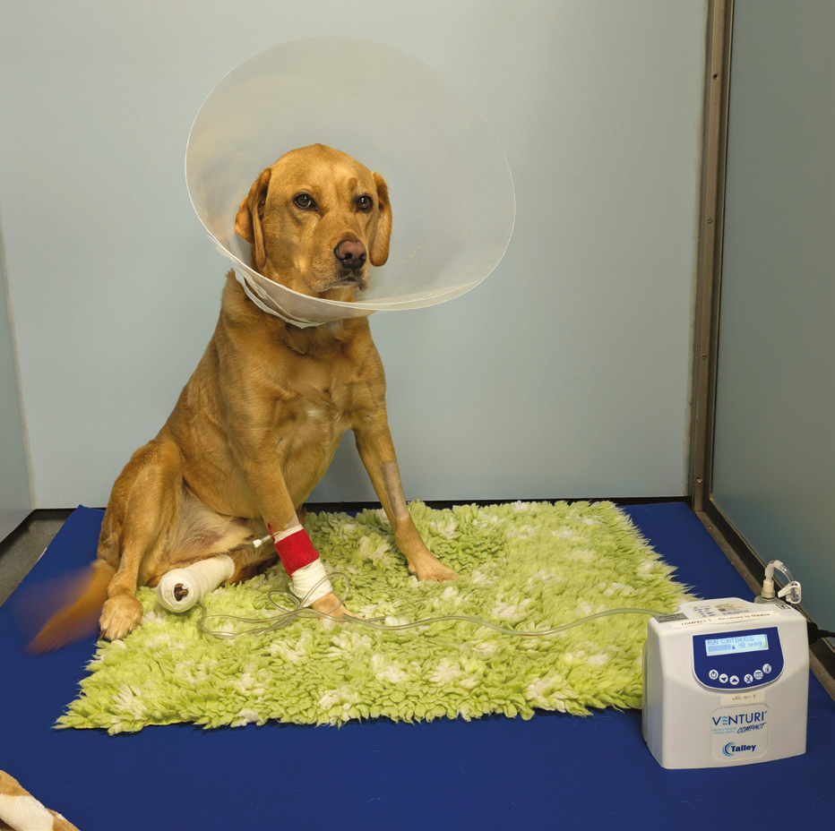 The effectiveness of negative-pressure wound therapy in optimising ...